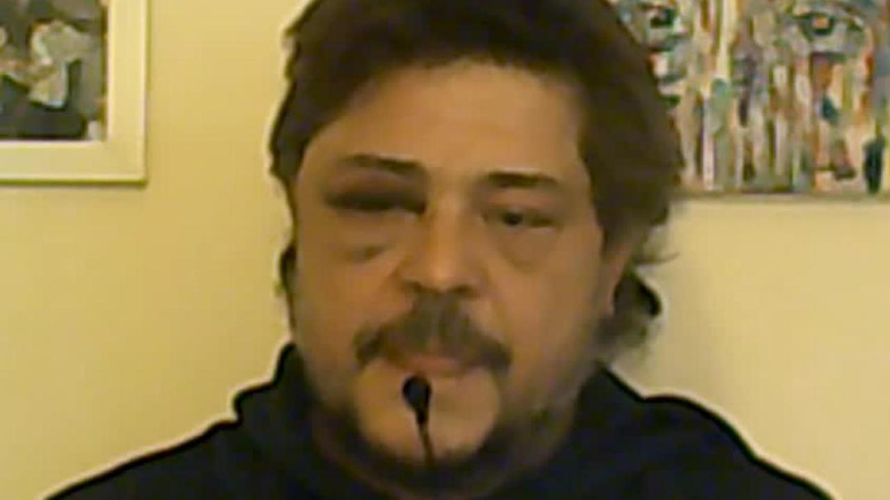 Il candidato Tony della Pia: "Pestato dalla polizia" | VIDEO - Le Iene